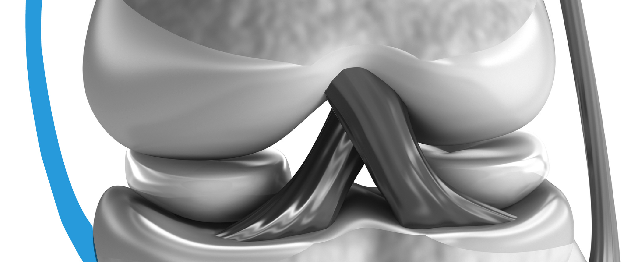 Lesión de ligamento medial de la rodilla | Dr. Alba